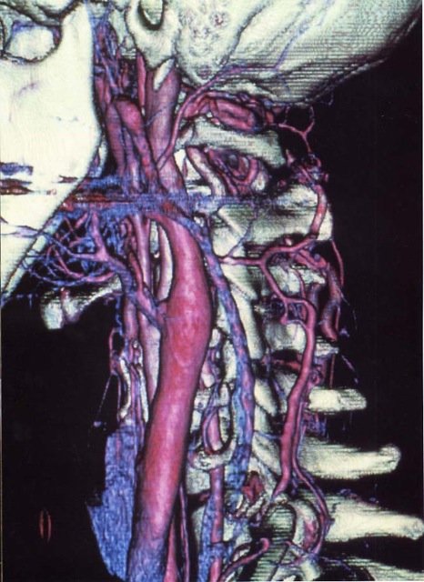 Musculoskeletal Radiology